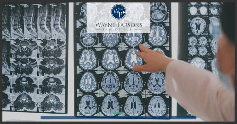 What Serious Functional Problems Can Be Caused by a Mild Traumatic ...